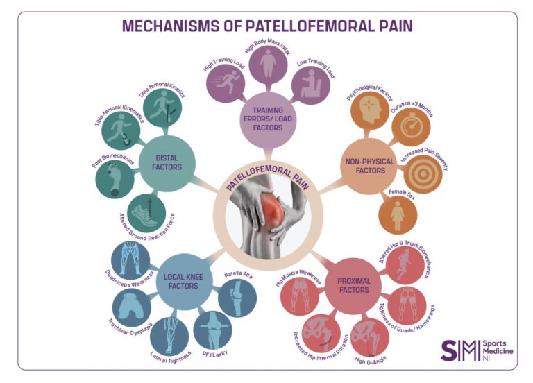 Patellofemoral Pain Syndrome. What is it? Risk factors. Belfast,