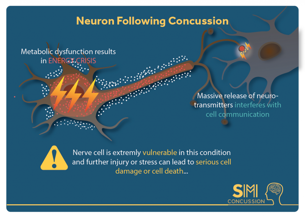 Brain changes during a concussion. Concussion clinic. Belfast. SMNI.